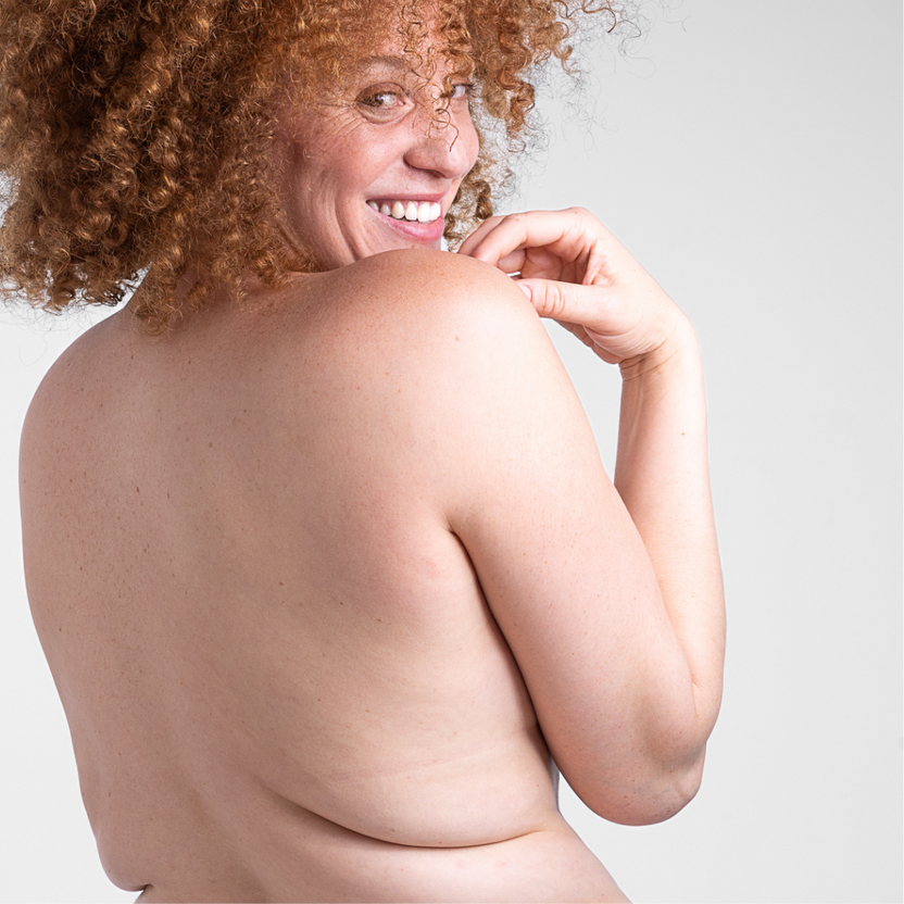 Intertrigo : comment prévenir et soulager cette irritation des plis cu