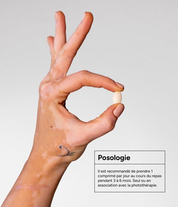 VITIX | Antioxidant tablets for vitiligo